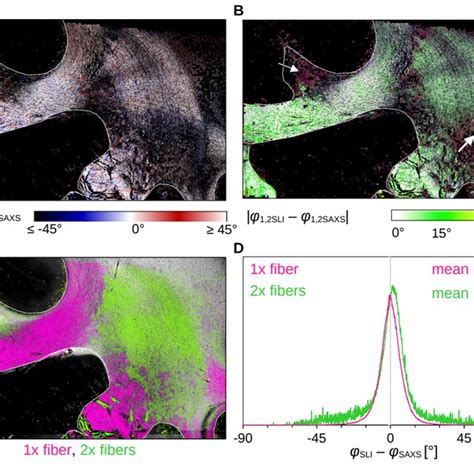 Angular Difference Between Nerve Fiber Orientations Sli Saxs For
