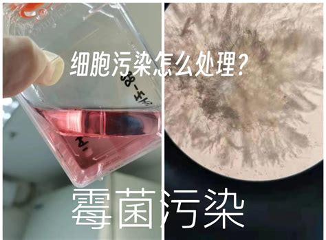 细胞污染的三种常见类型及处理方法