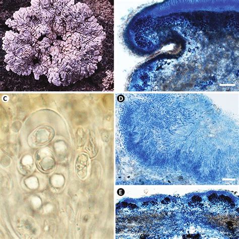Mycena Subcyanocephala A Basidiospores B Basidia C Download Scientific Diagram