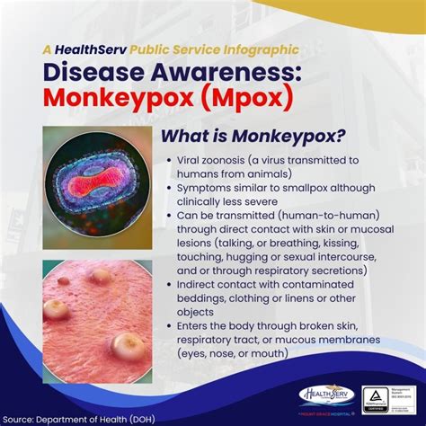 Understanding Monkeypox: What You Need to Know - Healthserv Los Baños ...