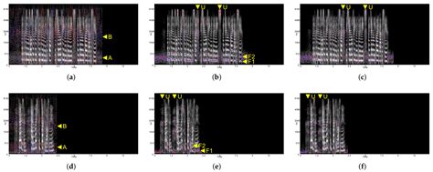 Applied Sciences Free Full Text Detecting Deepfake Voice Using