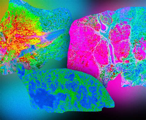 Bruker Launches Transformative Neoflex Maldi Tof System For Spatial