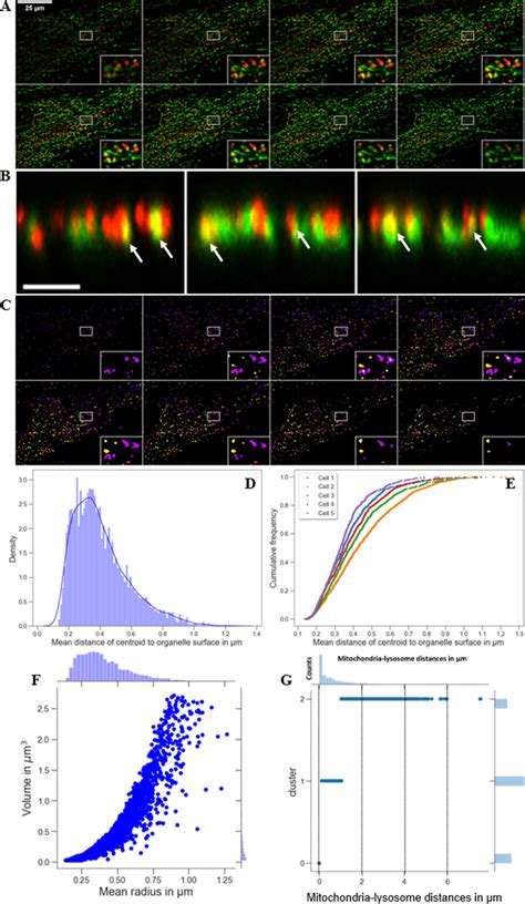 Centroid Based 3d Quantification Of Distances Between Lelyss