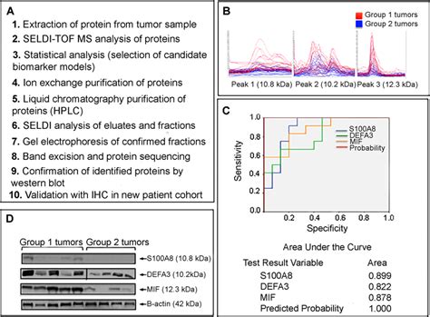 Identification Of Macrophage Migration Inhibitory Factor Mif In Gbm