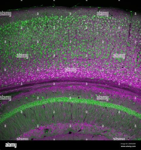 Cerebral Cortex And Part Of The Hippocampus In A Section Of A Mouse Brain Labelled With