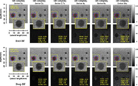 deep learning based universal beamformer for ultrasound imaging