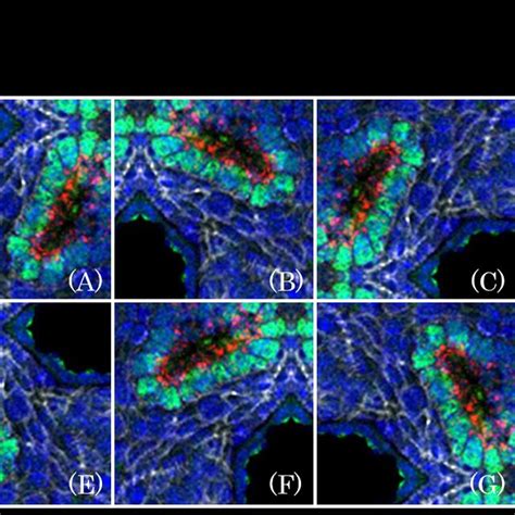 An Example Of Generated Images By Data Augmentation Techniques In Our Download Scientific