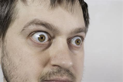 ¿qué Es La Tirotoxicosis Muy Salud