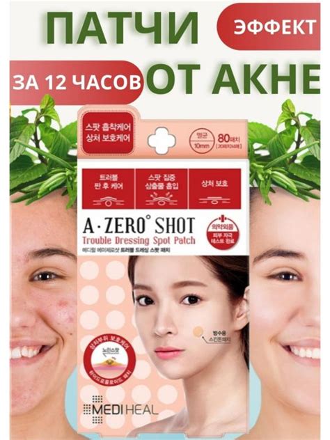 Корейские точечные патчи для лица против акне и прыщей a-zero shot ...