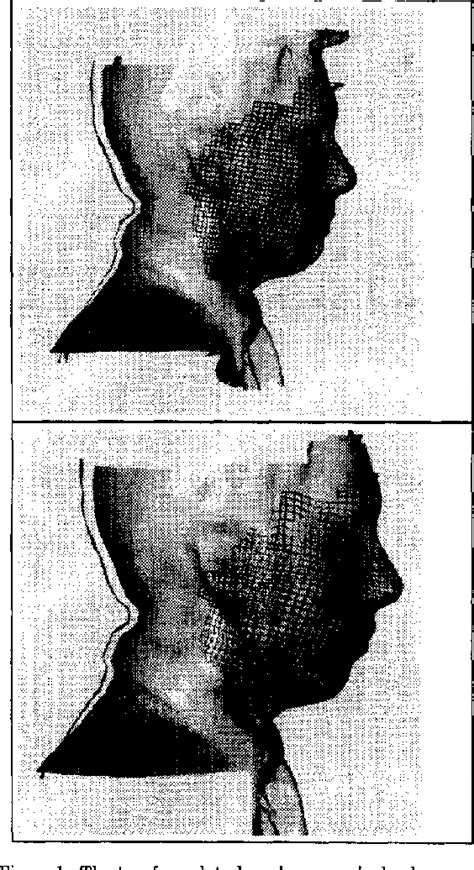 Affine Shape Adaptation Semantic Scholar