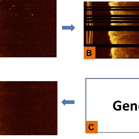 Test Phase Each Stent Strut Shadow In Post Stent Images A Was Download Scientific Diagram