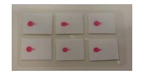 Microfluidic Paper Based Analytical Device For The Determination Of Nitrite And Nitrate