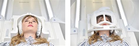 Cerebrospinal Fluid Flow Mri Csf Flow Mri Protocol And Planning