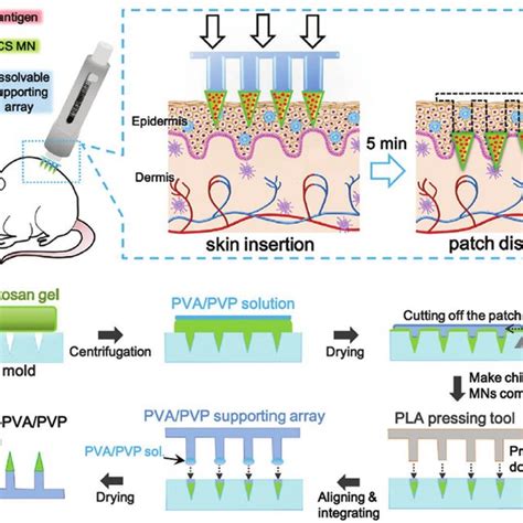 Classification Of Microneedle Platforms And Their Biomedical