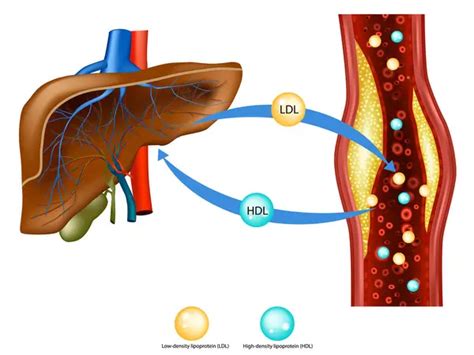 Clogged Arteries Free Stock Vectors