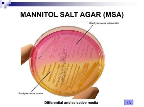 L13 Medical Microbiology Laboratory Staphylococcus Spp Pdf Ear