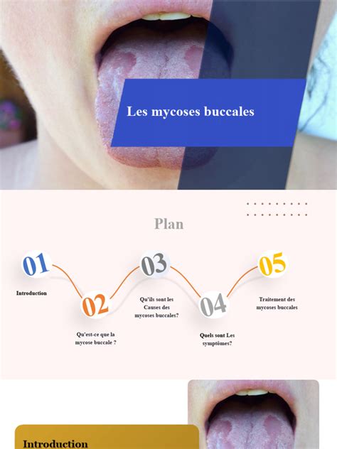 Mycoses Buccales Causes Et Traitements Pdf Candidose Candida