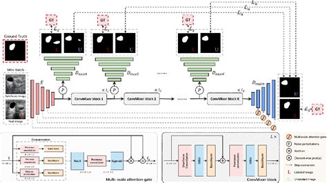 Figure 2 From Multi Level Global Context Cross Consistency Model For Semi Supervised Ultrasound