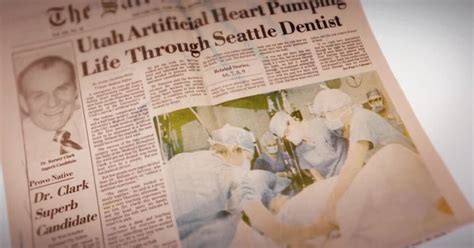 Jarvik 7 Is A University Of Utah Story With Heart Daily Transplant News