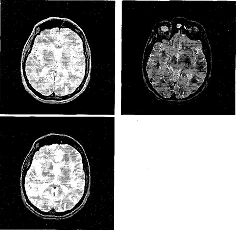 PDF Extension Of The ICP Algorithm To Non Rigid Intensity Based Registration Of D Volumes