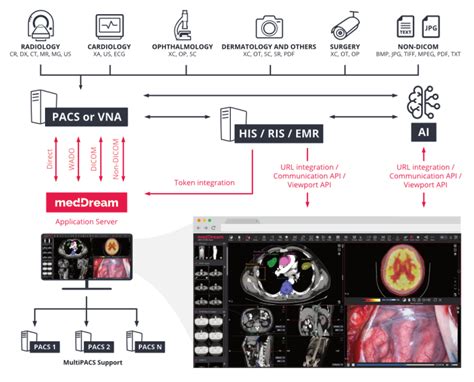 compatible with an open source dicom viewer integration meddream