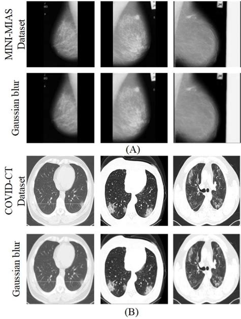 Figure 2 From Approach To Edge Detection In Medical Imaging Through Histogram Analysis And