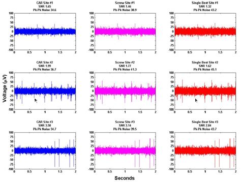3 Example Of Recordings With Low Correlated Noise Column One Depicts