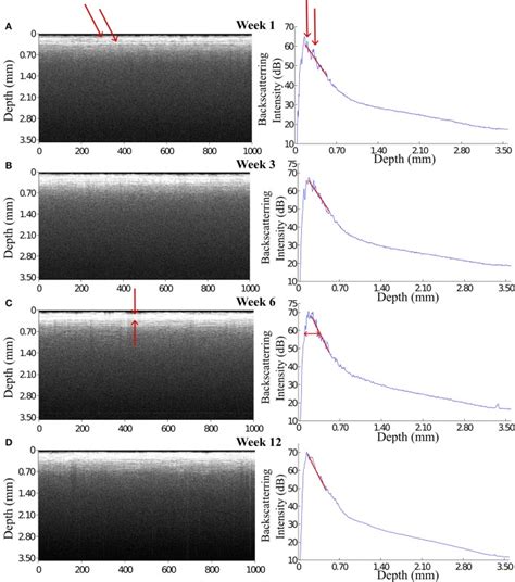 OCT Images And The Corresponding A Scan Profiles Acquired At Week Download Scientific