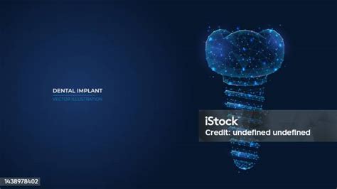 미래의 추상 치과 임플란트 기호 건강한 치아 구강 위생 치과 치료의 와이어 프레임 개념 낮은 폴리 기하학적 3d 벽지 배경 벡터