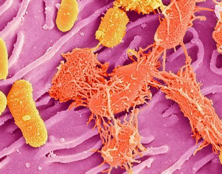 A New Understanding Of Whats Living On Your Skin Nih Intramural