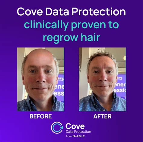 Cove Data Protection Clinically Proven To Regrow Hair N Able N Able