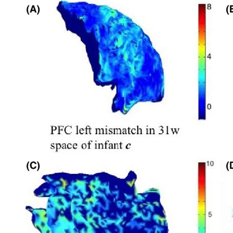 example maps of mismatching variation between the whole brain matching