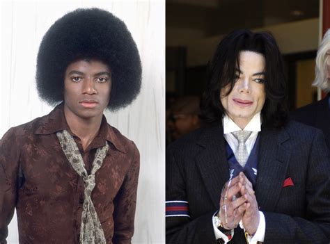 Before And After Plastic Surgery Michael Jackson