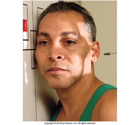 Facial Bones Pictures Flashcards Quizlet