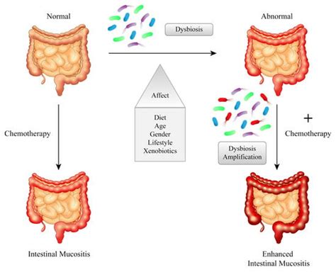Chemo Mucositis