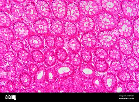 Human Large Intestine Colon Showing Mucosa With Lieberkhun Crypts X125 At 10 Cm Wide Stock