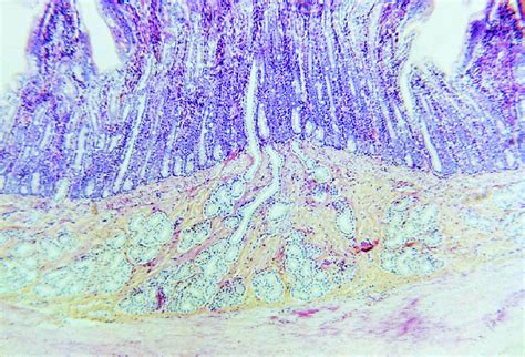 Duodenum Slide Prepared Slides