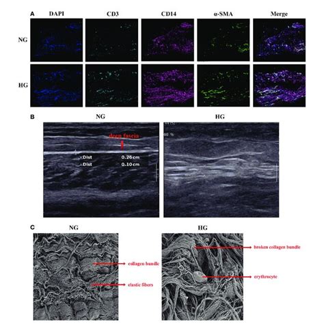 Multiplex Staining And Multispectral Imaging Ultrasound And Scanning