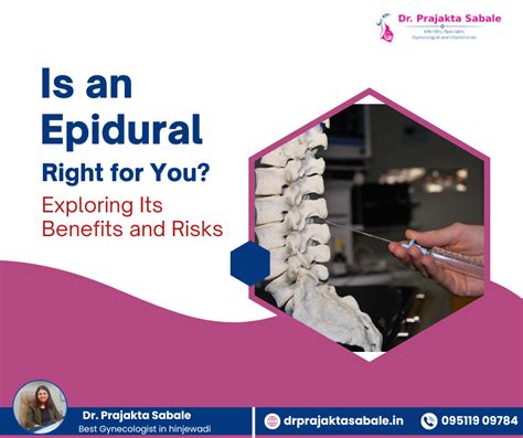 Is An Epidural Right For You Pros Cons Dr Prajakta Sabale
