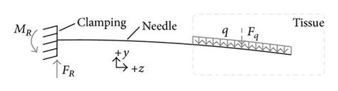 The Distributed Load Q Acting Along The Inserted Portion Of The Needle Download Scientific