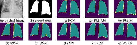 Calibrated Bagging Deep Learning For Image Semantic Segmentation A