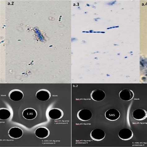 Species Assignment Of Five Streptococcus Mitis Strains Based Upon