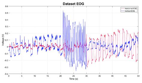 graphical representation of eog data set with both vertical and