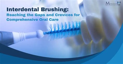 Interdental Brushing Reaching The Gaps And Crevices For Comprehensive