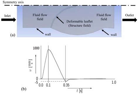 Numerical Model Geometry With Boundary Conditions A Patient Specific