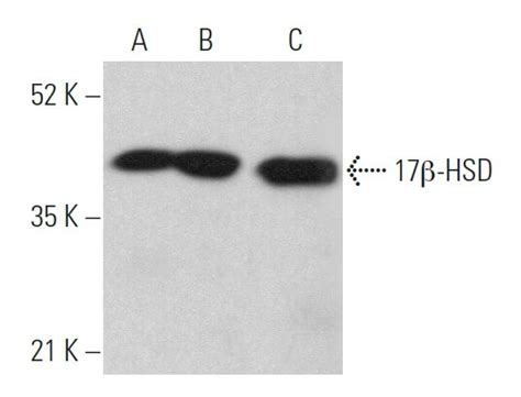 Anti 17β Hsd Antibody D 8 Scbt Santa Cruz Biotechnology