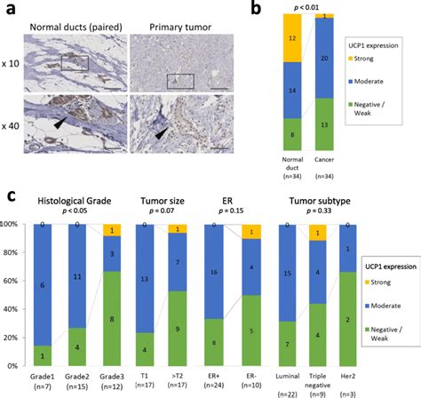 Association Of Ucp1 Expression With Clinicopathological Features Of Download Scientific Diagram