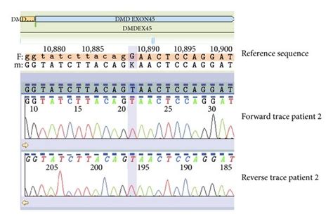 Sequence Electropherograms A B And C The C1594ct