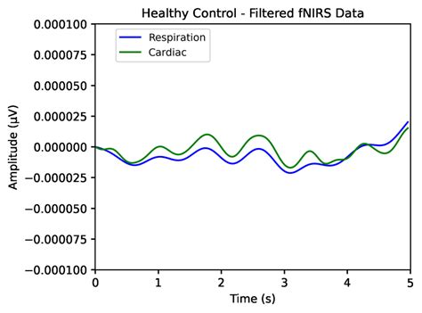 Comparison Of Band Passed Eeg Ecg And Fnirs Signals Of Healthy