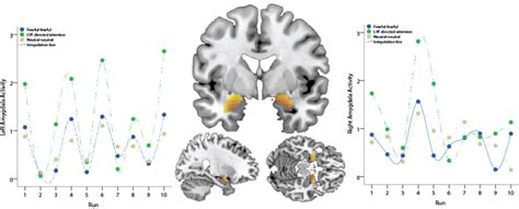 The Backward Masked Fearful Face Dot Probe Task Of Attentional Bias Download Scientific Diagram
